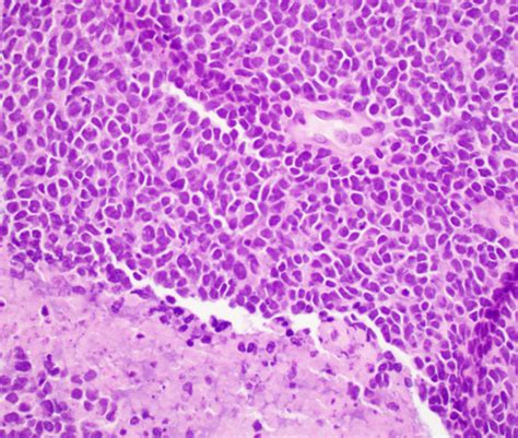 You Are Being Redirected