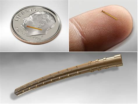 Devices Expanding Horizons Minimally Invasive Glaucoma Surgery Mivision