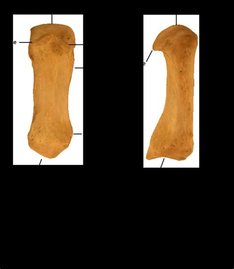 Right First Metacarpal Of Homo Sapiens Specimen Mnhn 35055 Ventral