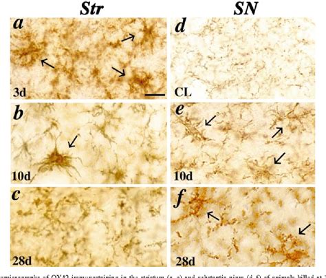 Figure 3 From Neuroin ̄ammation Of The Nigrostriatal Pathway During