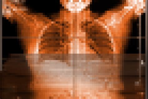 Бездимните алтернативи и редукция на риска от развитие на рак на бели