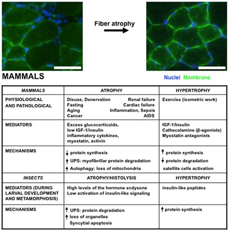 Hypertrophy Hypotrophy Cells