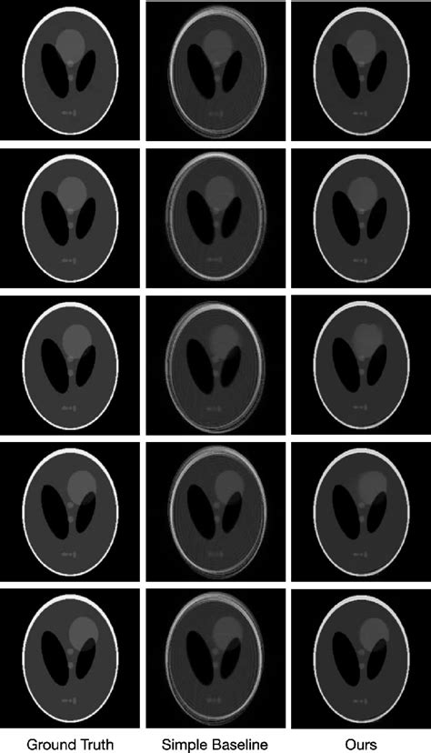 Figure 1 From Volumetric Reconstruction Resolves Off Resonance Artifacts In Static And Dynamic
