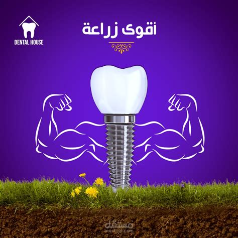 تصميمات احترافيه للسوشيال ميديا فى مجال زراعة الاسنان مستقل