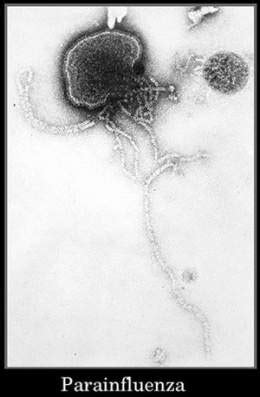 Enfermedades Por Virus De Parainfluenza Ecured