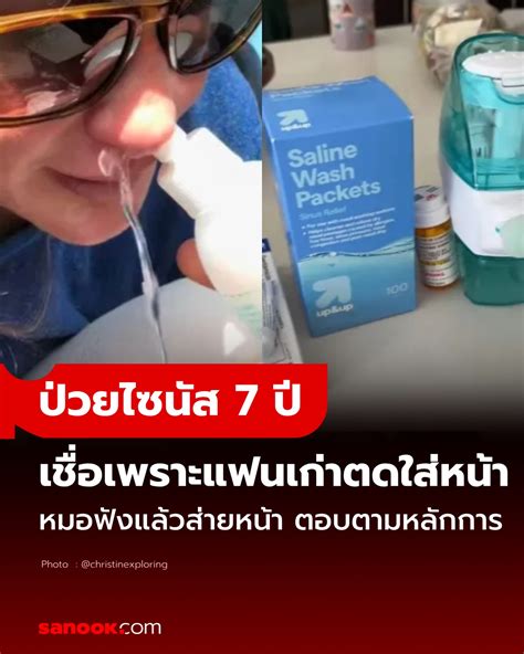 Sanook สาวป่วยไซนัสอักเสบเรื้อรัง 7 ปี เชื่อสาเหตุเพราะแฟนเก่า ตดใส่หน้า หมอฟังแล้วส่ายหน้า
