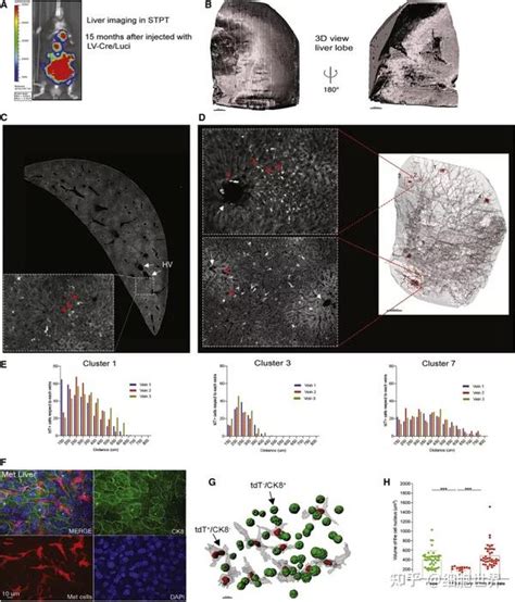 Cell Reports 冷泉港实验室单细胞分辨率器官3d重建研究前列腺癌 知乎