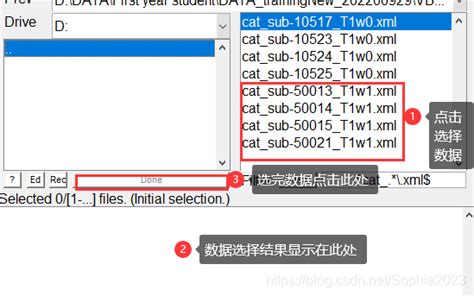基于cat12和spm12进行vbmandsbm数据分析笔记1——数据预处理 csdn博客