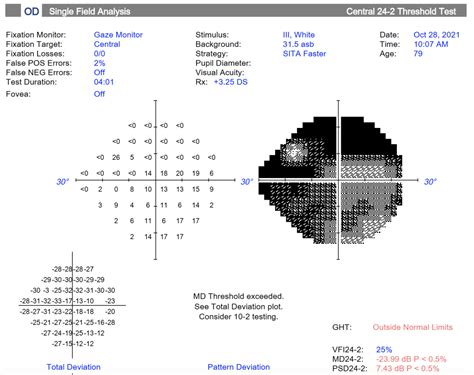 The Best Vitamins For Glaucoma And Neuroprotection Vision And Eye Health