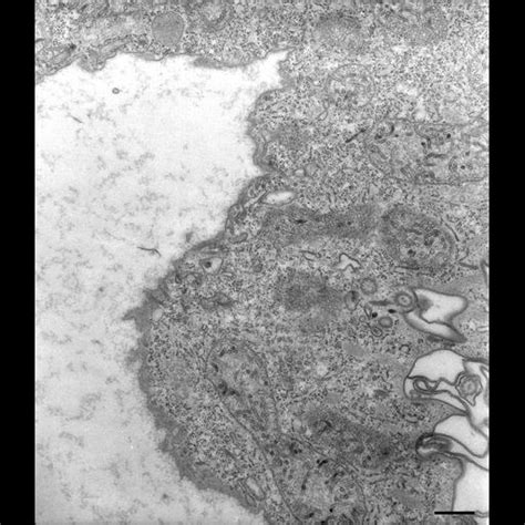 Cil36753 Paramecium Multimicronucleatum Cell By Organism Eukaryotic