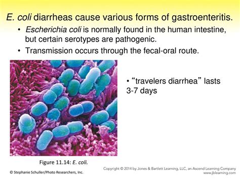 Foodborne And Waterborne Bacterial Diseases Ppt Download