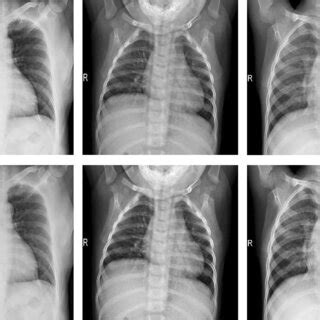 The First Row Presents The Original Xray Images The Second Row Download Scientific Diagram