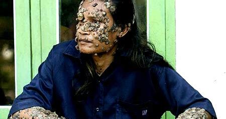 BCN Photos The Forgotten Story Of The Tree Man