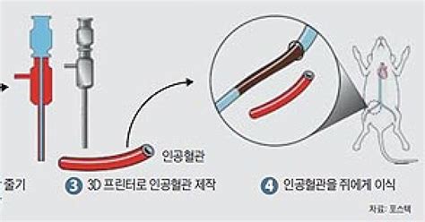 3d 프린터로 만든 인공혈관