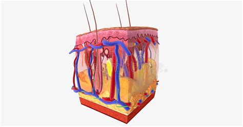 Angioedema Is A Swelling Of The Dermis And Subcutaneous Tissue Stock Illustration Illustration