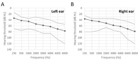 Pure Tone Audiometric Thresholds Db Hl Across Participants Plotted