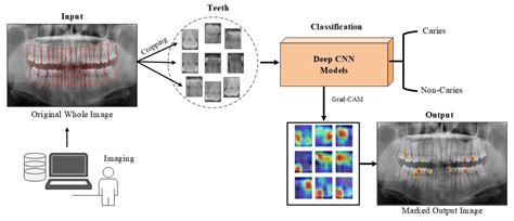 An Explainable Deep Learning Model To Prediction Dental Caries Using