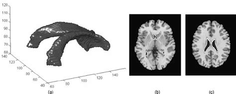 An Example Of The Mri Volume Segmentation By Three Dimensional Download Scientific Diagram