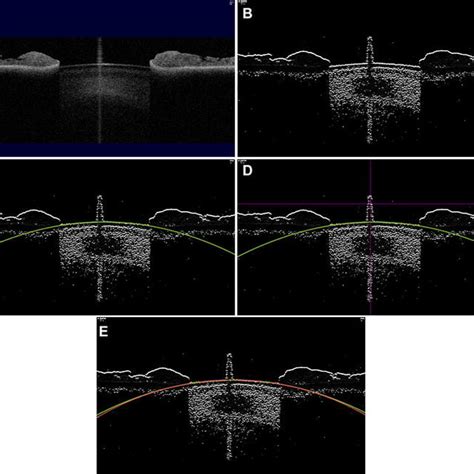representative images showing the procedure followed in the