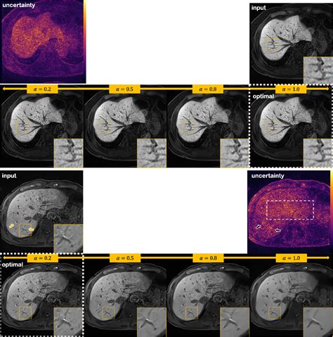 mr image denoising and super resolution using regularized reverse diffusion