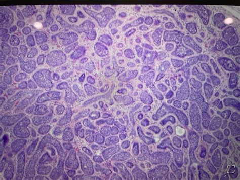 Derm Flashcards Quizlet Derm Flashcards Quizlet