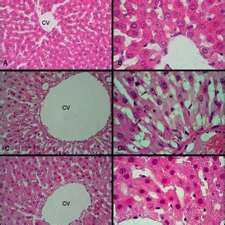 Proposed Mechanism Of AKI Associated With TLS Download Scientific Diagram