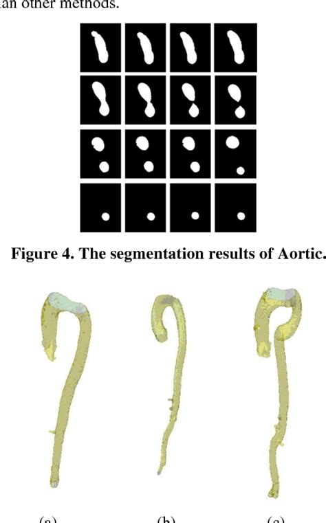Figure 1 From Automatic 3d Aorta Segmentation In Ct Images Semantic Scholar