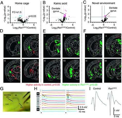 Brain Wide Activity Mapping Uncovers Elevated Dentate Network