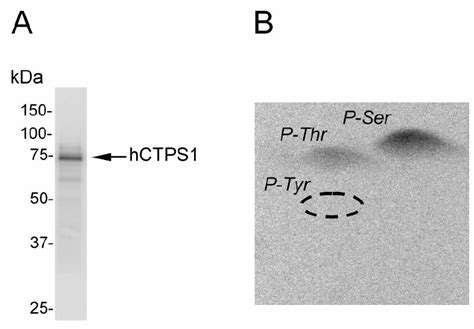 Phosphorylation And Phosphoamino Acid Analysis Of E Coli Expressed Download Scientific