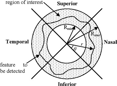 Figure 1 From Optic Nerve Head Segmentation Using Genetic Active Contours Semantic Scholar