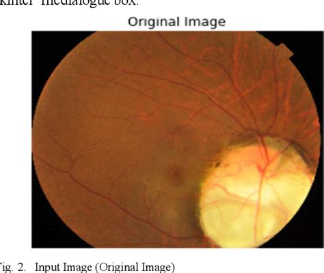 Figure 2 From Early Diagnosis Of Types Of Glaucoma Using Multi Feature Analysis Based On Dbn