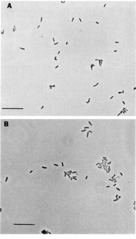 Actinomyces Pyogenes