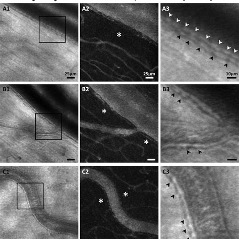 Retinal Vasculature Obtained From Three Different Subjects The