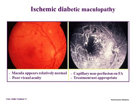 How To Keep Your Sight For Life Ppt Video Online Download
