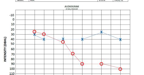 AUDIOGRAM WORKSHEET AUDIOLOGIS
