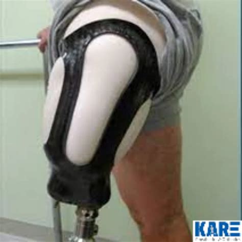 Hifi Interface Socket Prostheses Full Leg At Best Price In Bengaluru