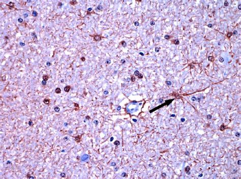 Anti S100 Immunolabeled Astrocytes Arrow In The Cerebellar White Download Scientific Diagram