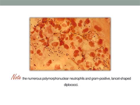 Ppt Sputum Culture Powerpoint Presentation Free Download Id5731153