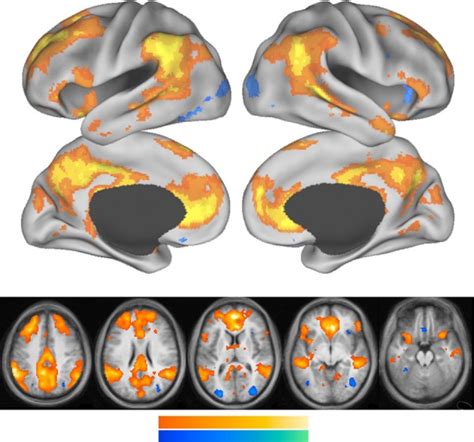 This Figure Is From Andrews Hanna Et Al 2010 Whole Brain