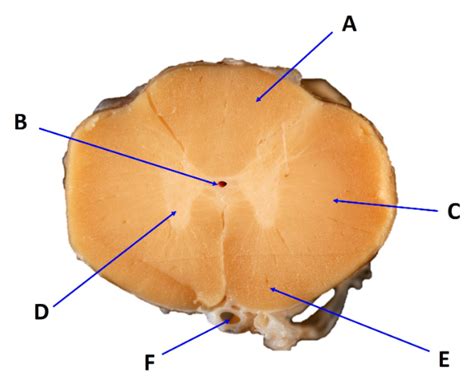 Diagram Of Neuroanatomy Postlab 2 Quizlet