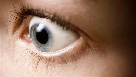 ما هو جحوظ العين وما أسبابه وكيفية علاجه؟ علاجك الطبية