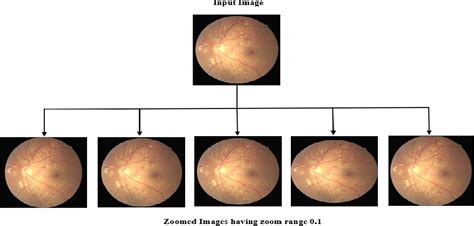 Figure 7 From Efficientnet Based Diabetic Retinopathy Classification