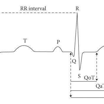 Schematic Presentation Of Measurement Of QT Intervals Corrected QT Download Scientific Diagram