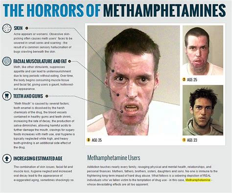 Meth Addict S Transformation After Being Drug Free For 90 Days Daily