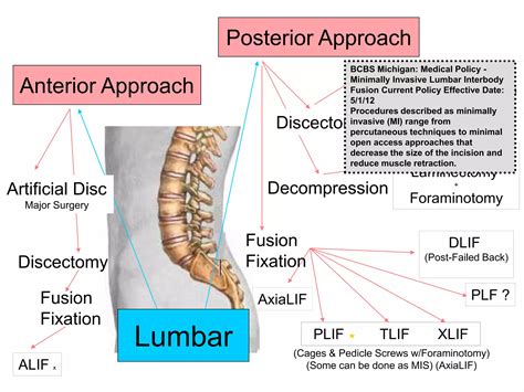 Laminectomy Vs Discectomy In Rehabilitation Ppt
