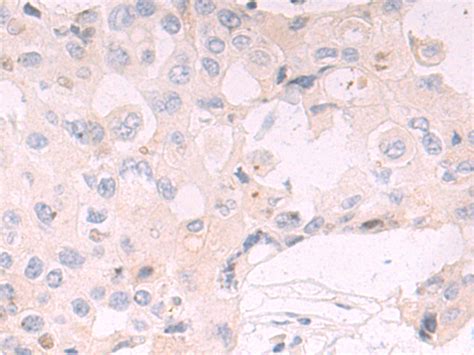 兔抗nnmt多克隆抗体anti Nnmt Rabbit Polyclonal Antibody 生命科学产品与技术服务 生工生物工程上海