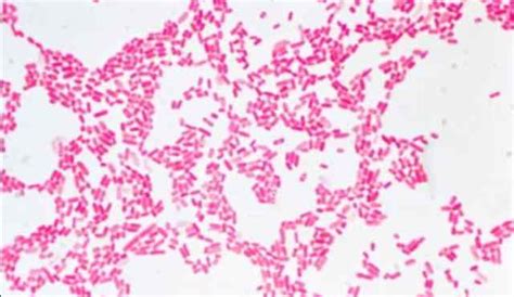 Gram Stain Purpose Principle Procedure Complete Guide