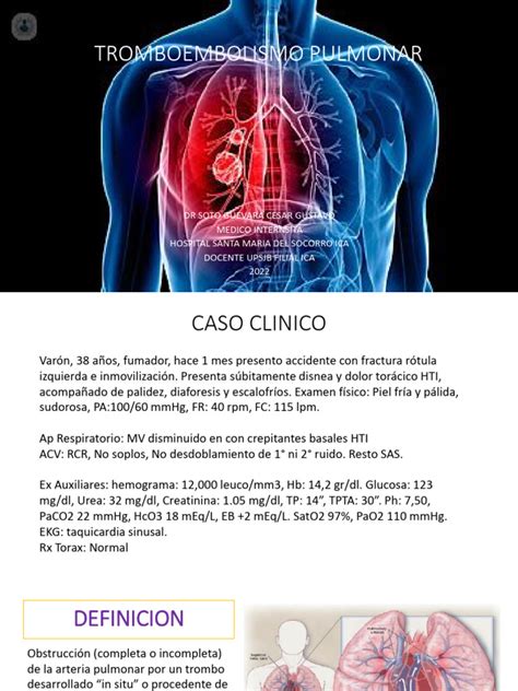 3 Tromboembolismo Pulmonar | PDF