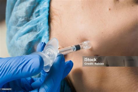 히알루론산의 필러 주입 코 턱 광대뼈 사원의 부피와 모양을 교정하기위한 윤곽 플라스틱 의료 클리닉에서 화장품 젊어지게 하는 안면 치료 25 29세에 대한 스톡 사진 및 기타