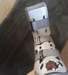 Broke Foot S Tenor